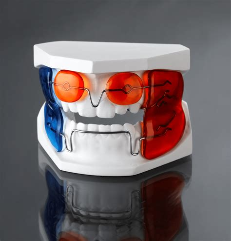 La malocclusione di classe III - dott. Gennaro Vittozzi