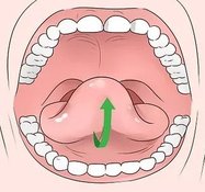 Il frenulo linguale - osservazioni - dott. Gennaro Vittozzi